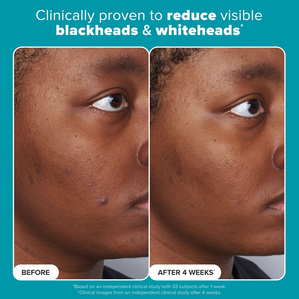 Paula's Choice Skin Perfecting 2% BHA Liquid Exfoliant | Space NK