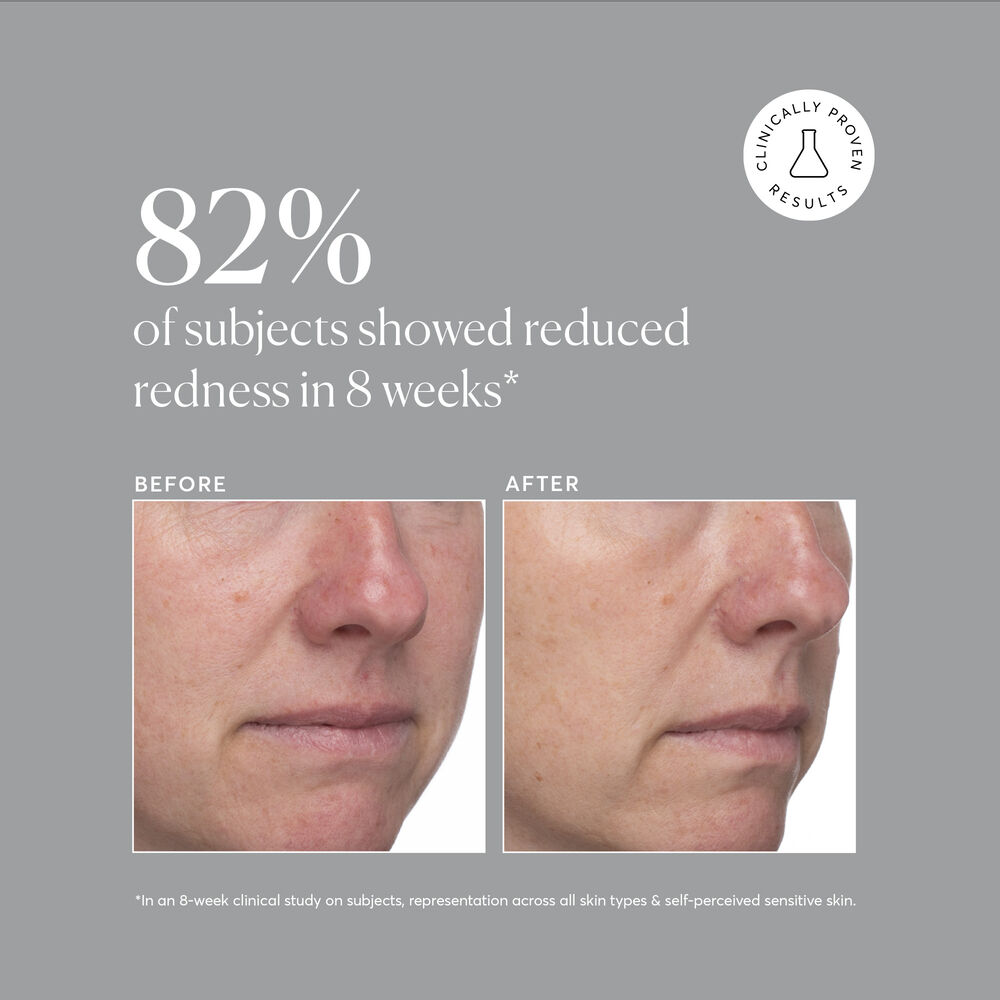 NATURIUM Azelaic Acid 10% | Space NK